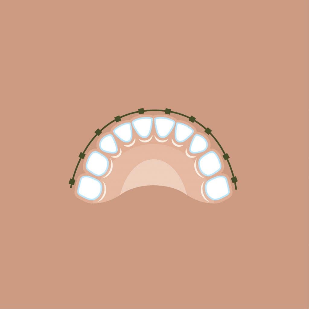 Corinna St Orthodontics: Traditional braces