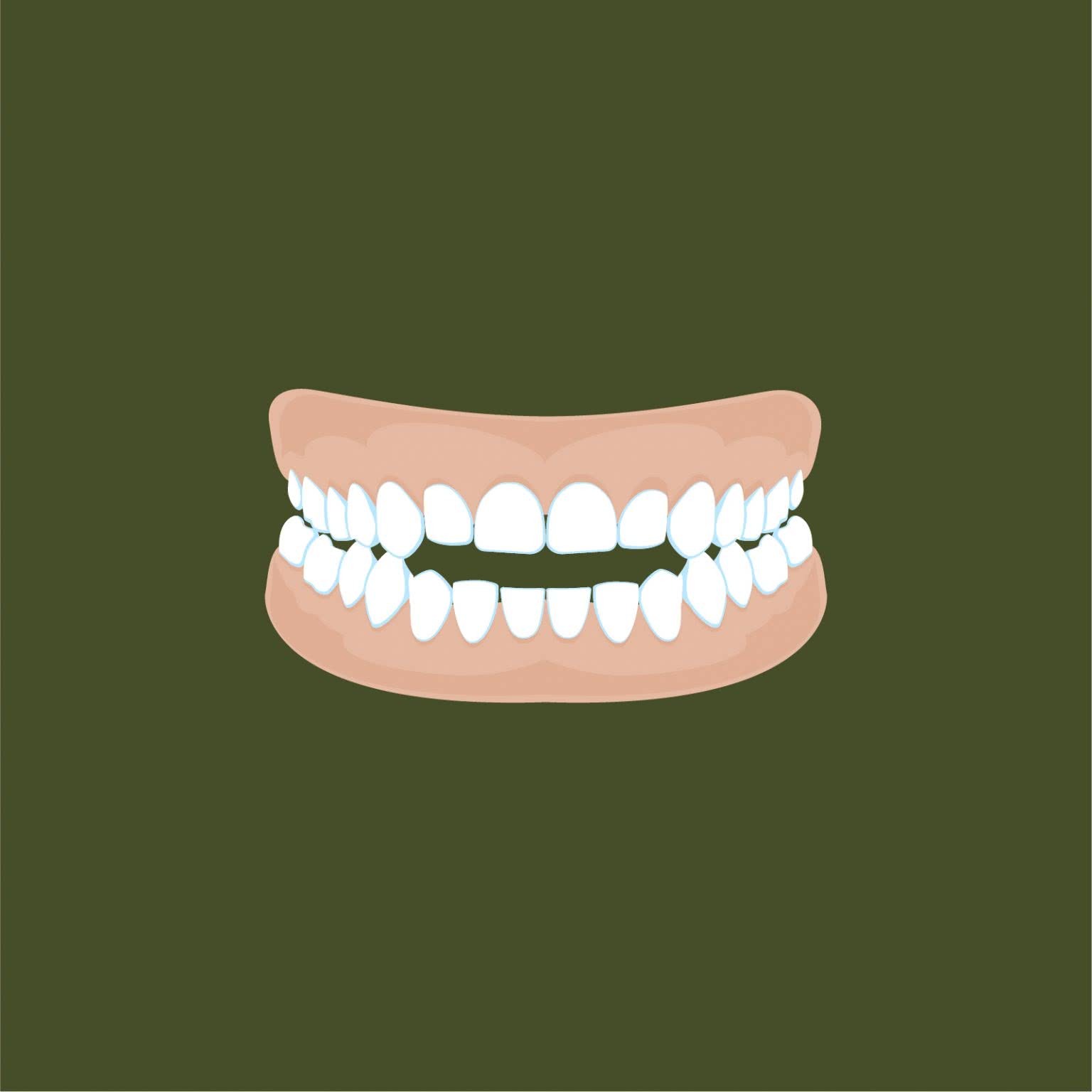 Corinna St Orthodontics: Openbite